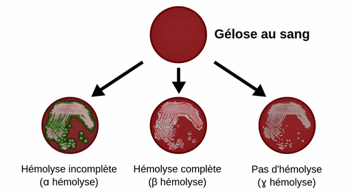 Les milieux différentiels et les milieux sélectifs - Labster