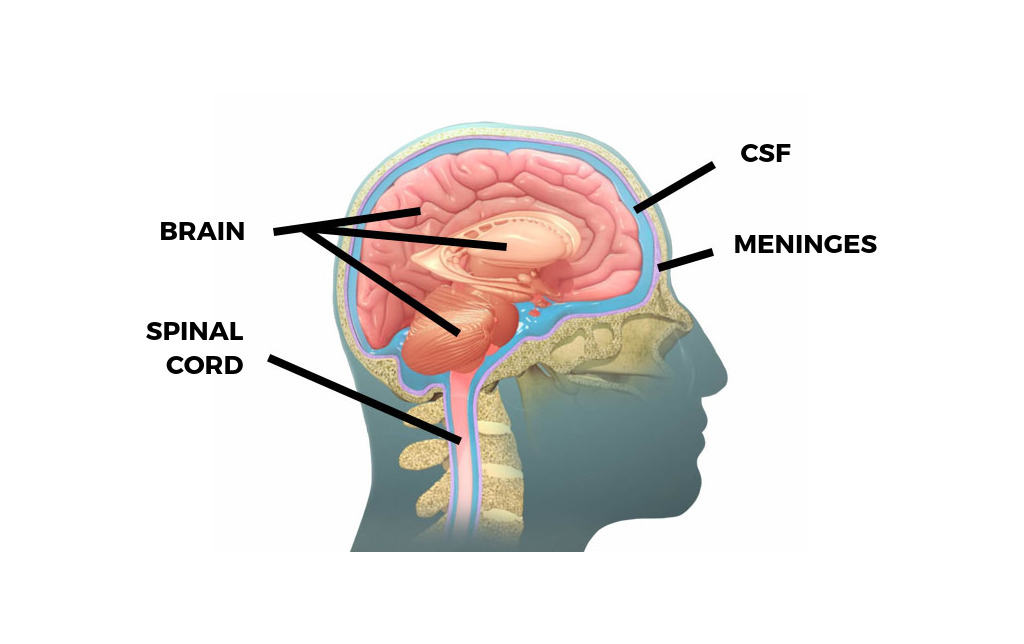 Meningitis Labster