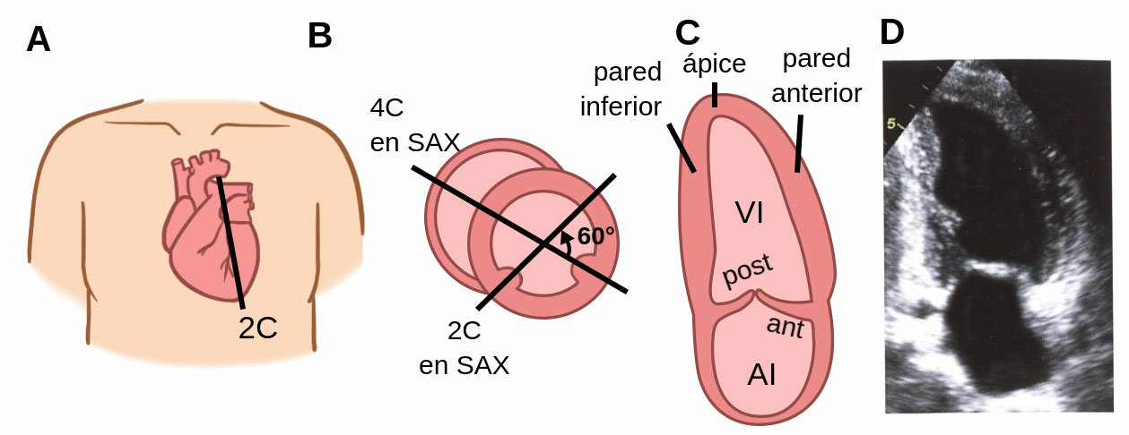 Vista apical de dos cámaras - Labster