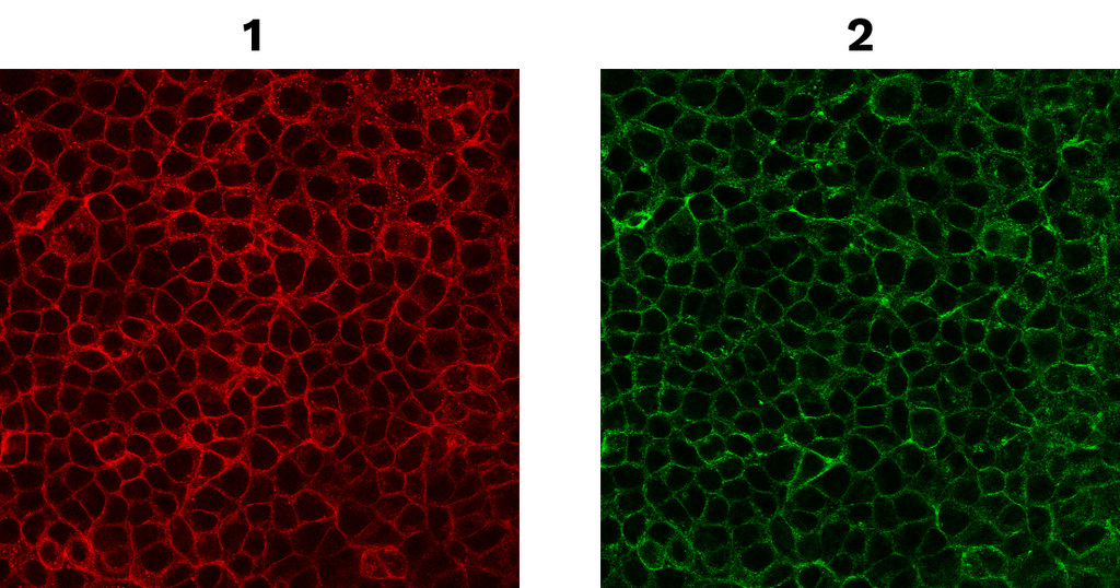 E-cadherin and F-actin basal expression in epithelial cells - Labster