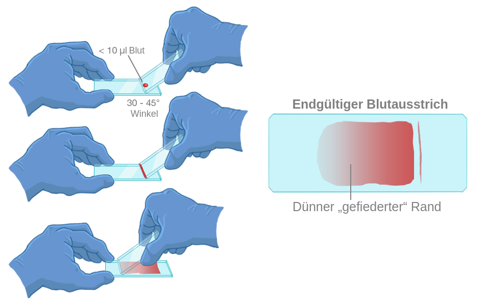 Peripherer Blutausstrich - Labster Theory